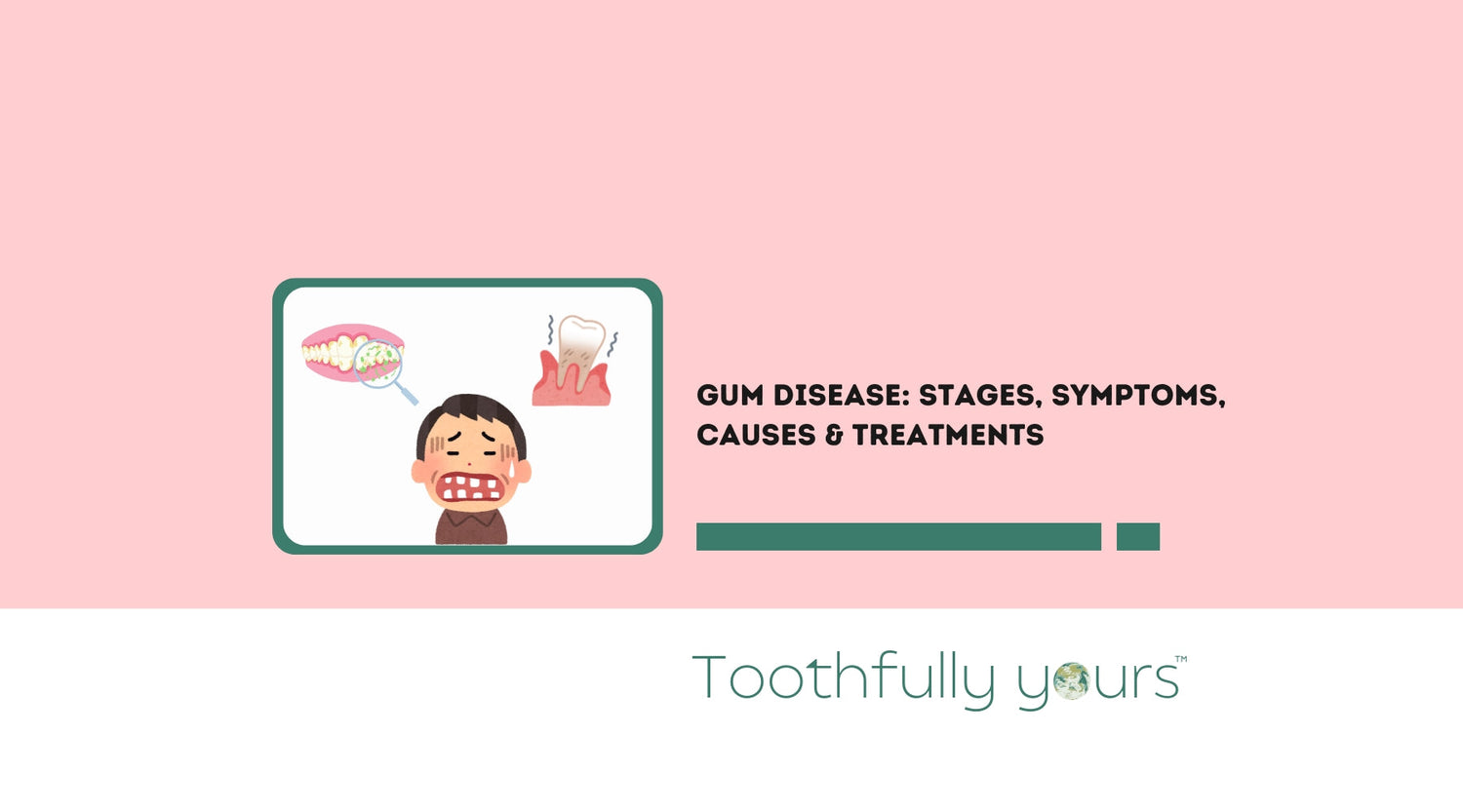 Gum Disease: Stages, Symptoms, Causes & Treatments | Toothfully Yours ...
